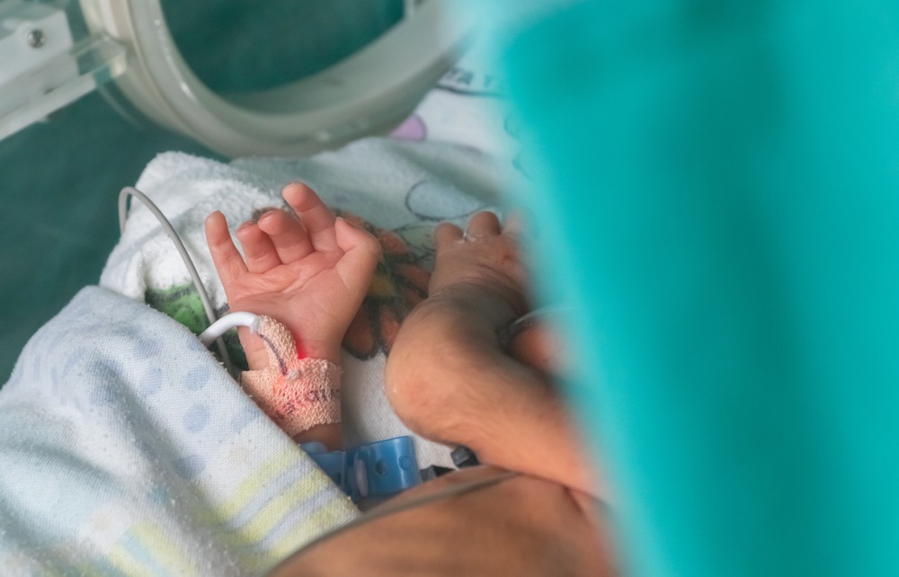What are the Different Kinds of Newborn Brain Hemorrhage You Can Sue ...